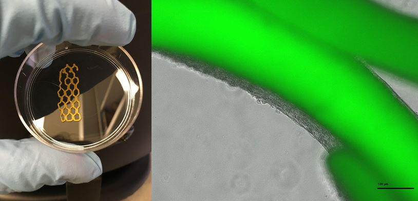 Personalized Nutrition